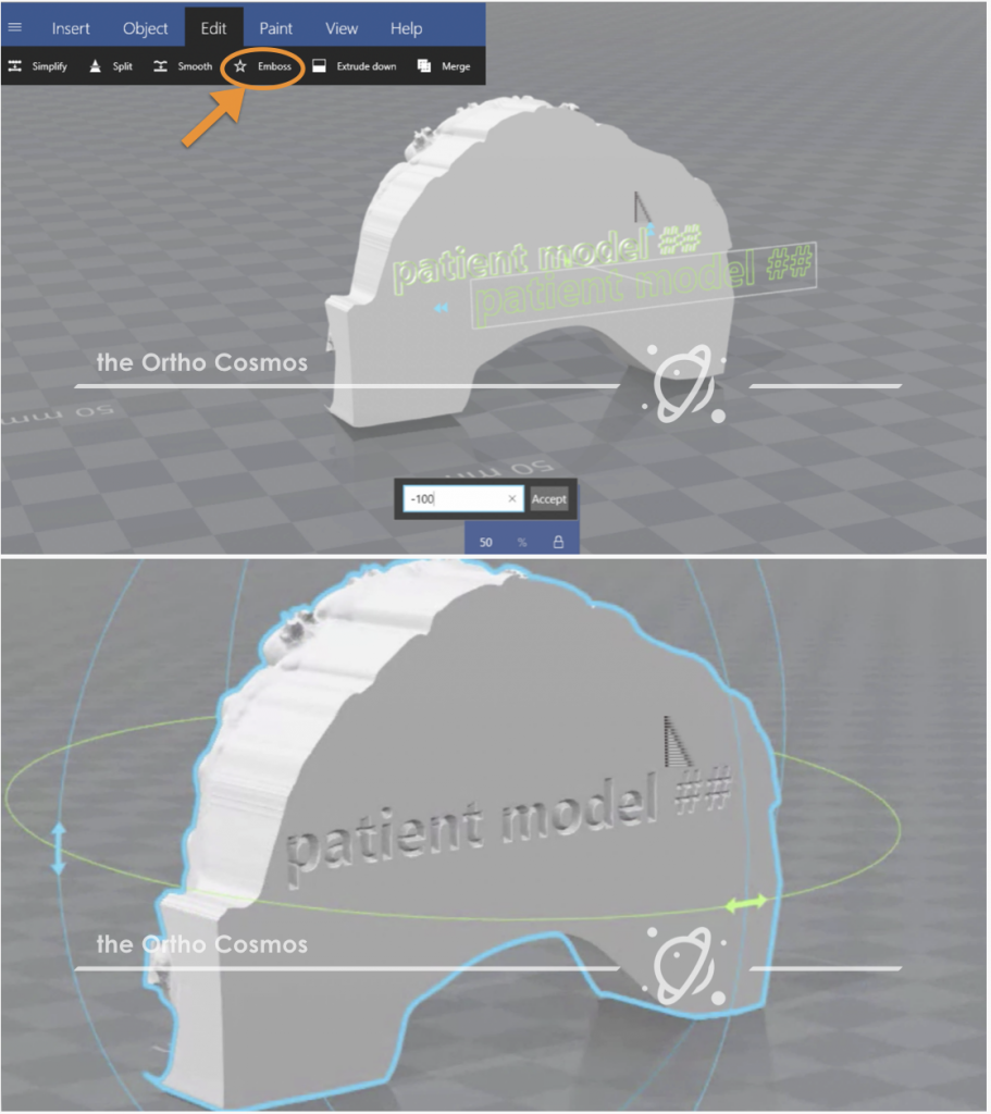 Using 3D Builder in Orthodontics - The Ortho Cosmos