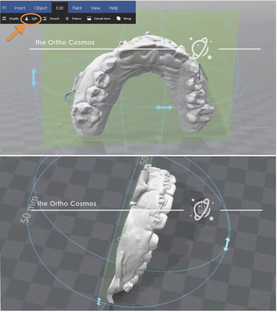 Using 3D Builder in Orthodontics - The Ortho Cosmos