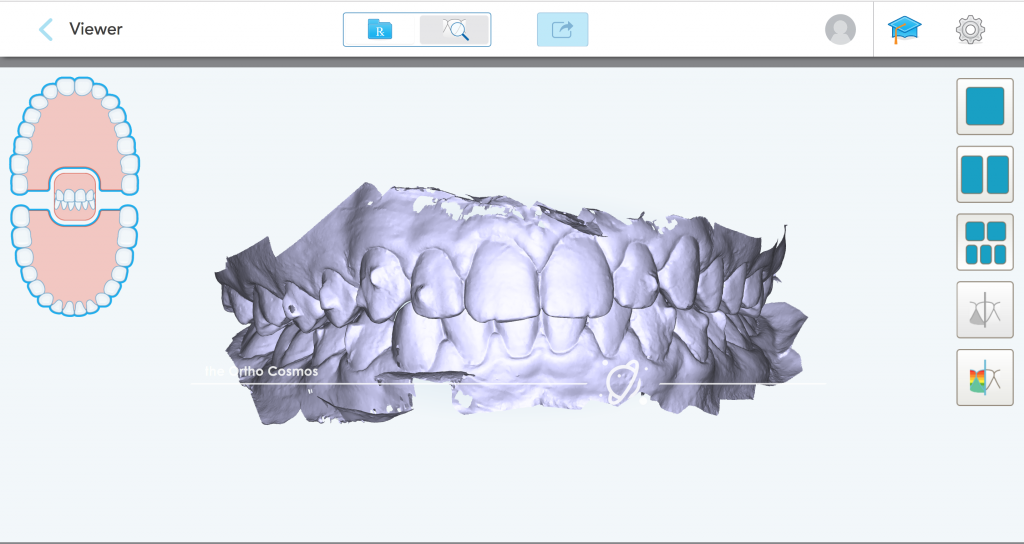 Details on the myiTero.com Update - The Ortho Cosmos