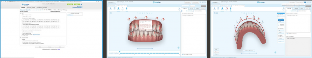 Invisalign Archives - The Ortho Cosmos